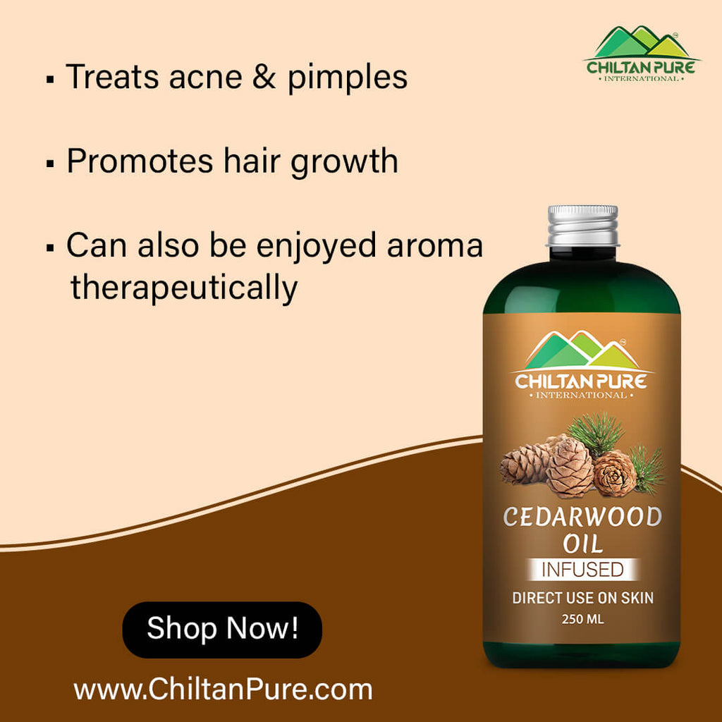 Cedarwood Oil – Healthy skin best friend – Contains anti-inflammatory ...