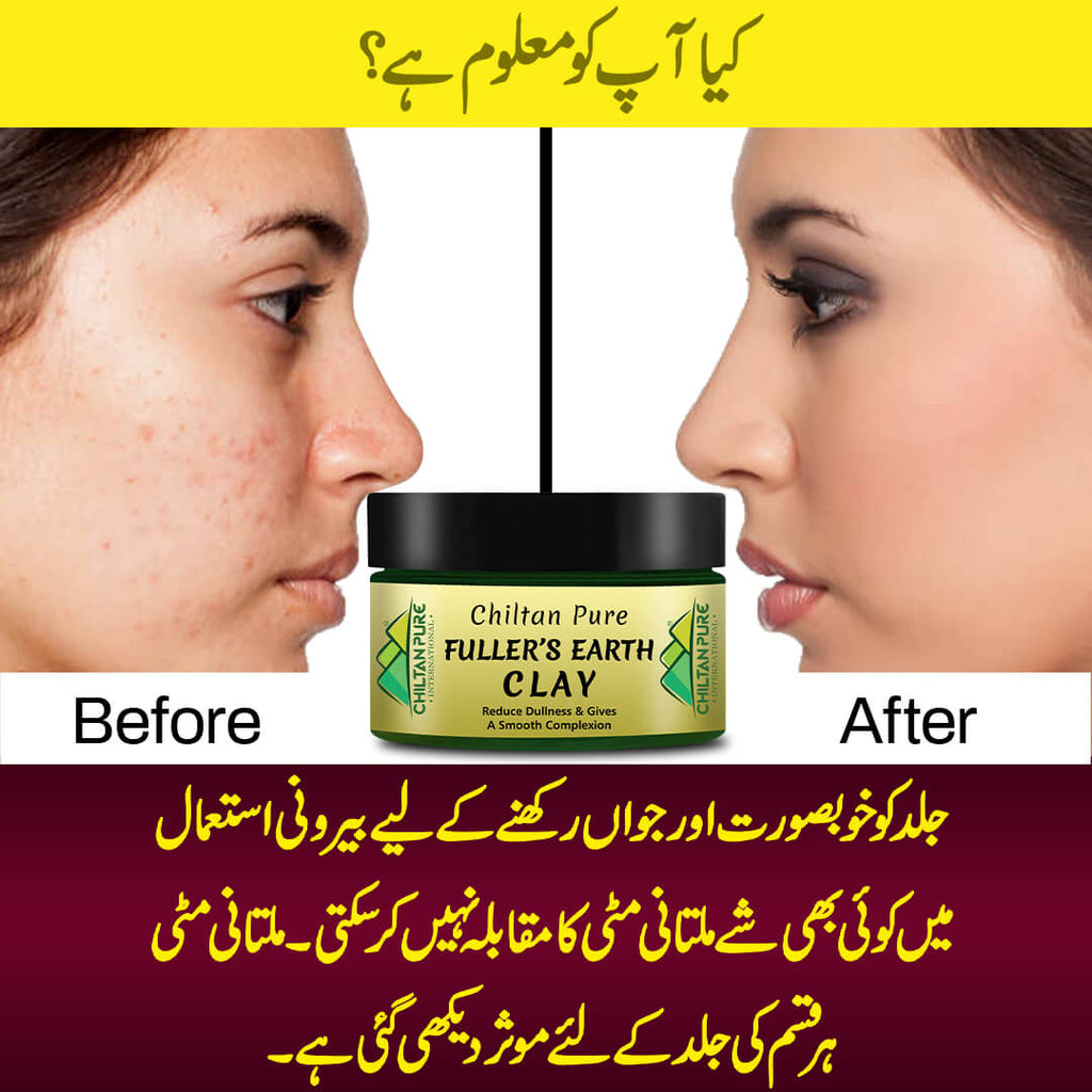 Fuller's Earth Clay - Acne Fighter Clay [Multani Mitti][For Oily Skin ...