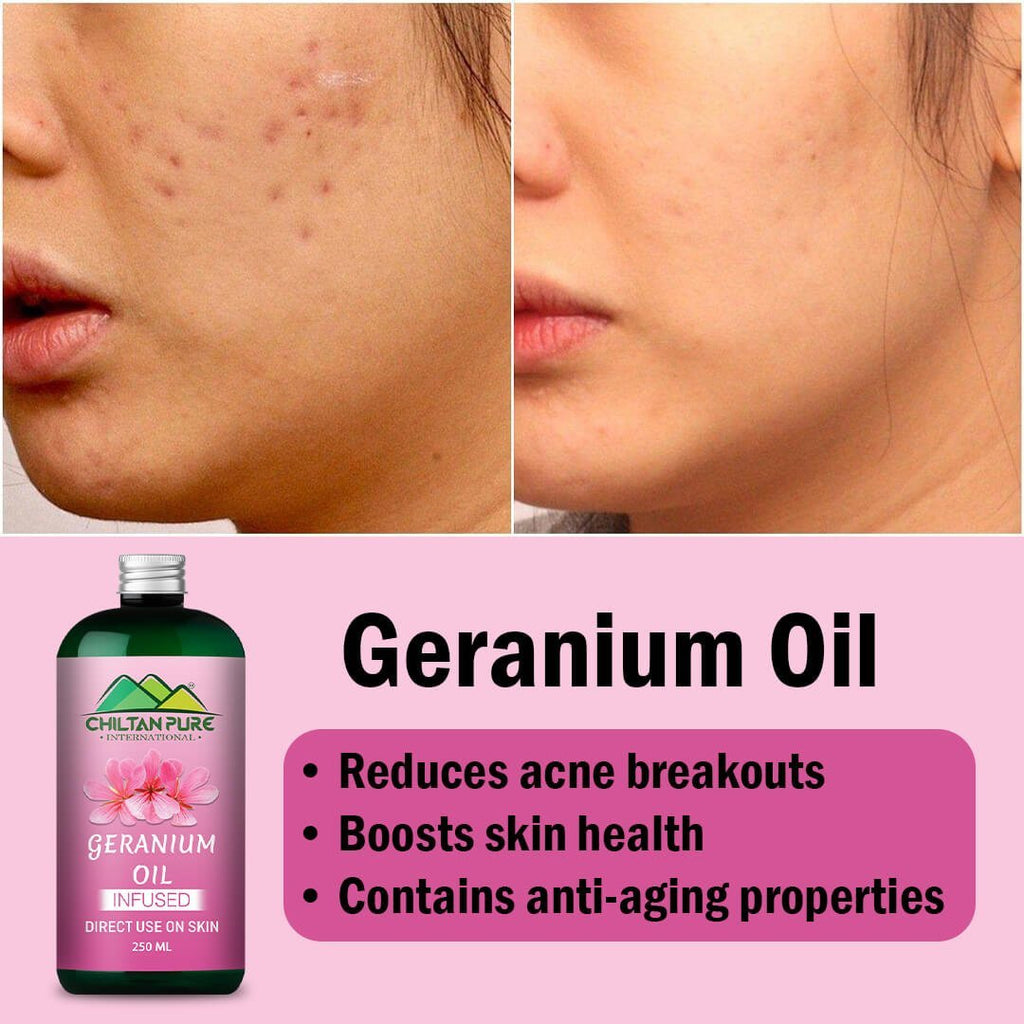 Geranium Oil – Relax with sweet aroma – Contains anti-bacterial & anti ...