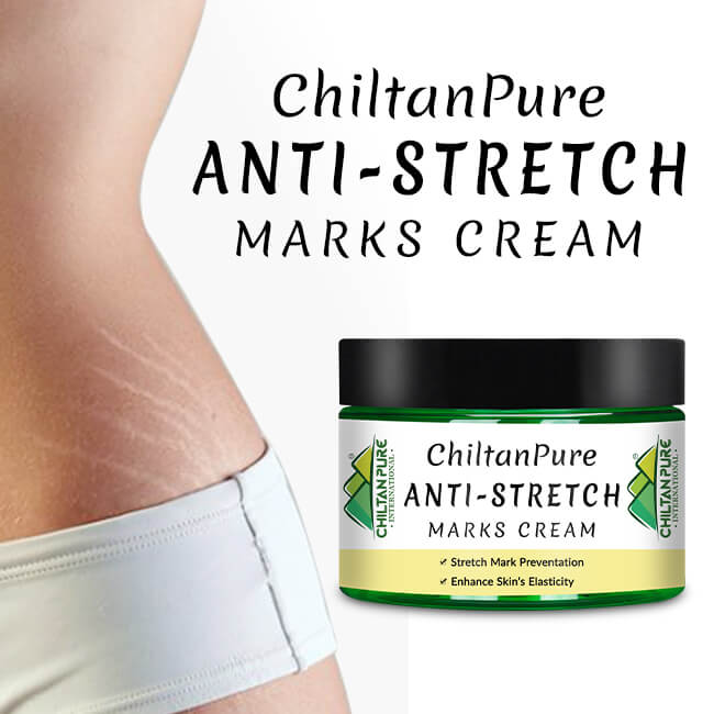 Anti-Stretch Marks Cream – Formulated With Shea Butter, Coco Butter ...